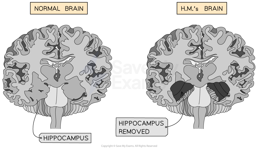 Idiographic & Nomothetic Approaches | AQA A Level Psychology Revision ...