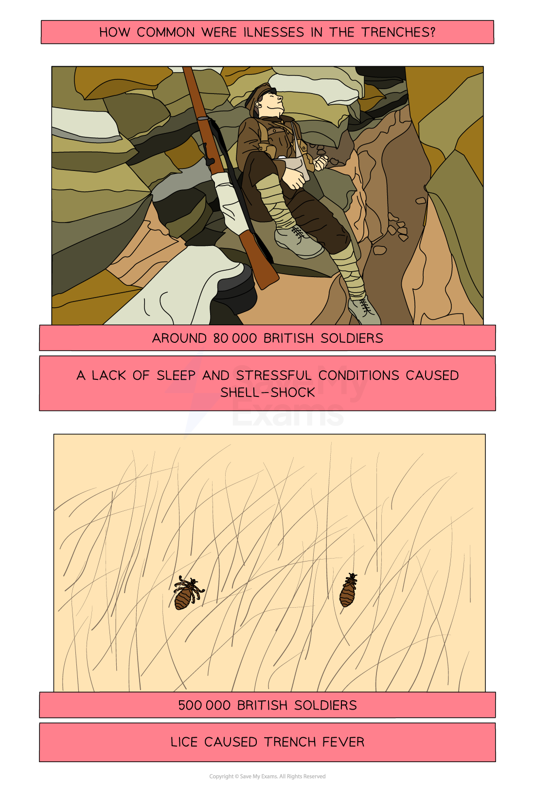 What Is Trench Fever World War 1 - Infoupdate.org